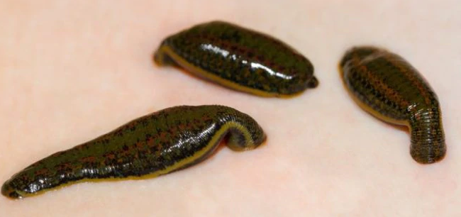7 stages of leech – housegoeshome
